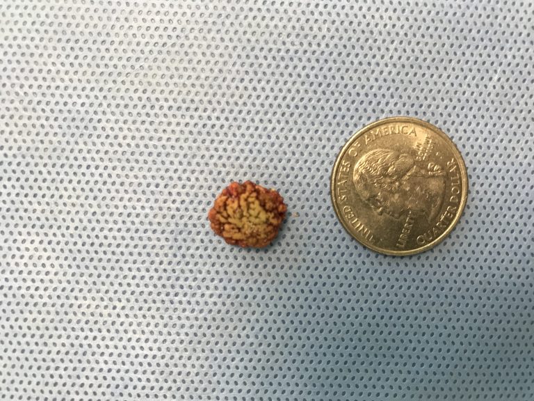 Toto can’t pee because of bladder stones! | Dr Phil Zeltzman’s Blog